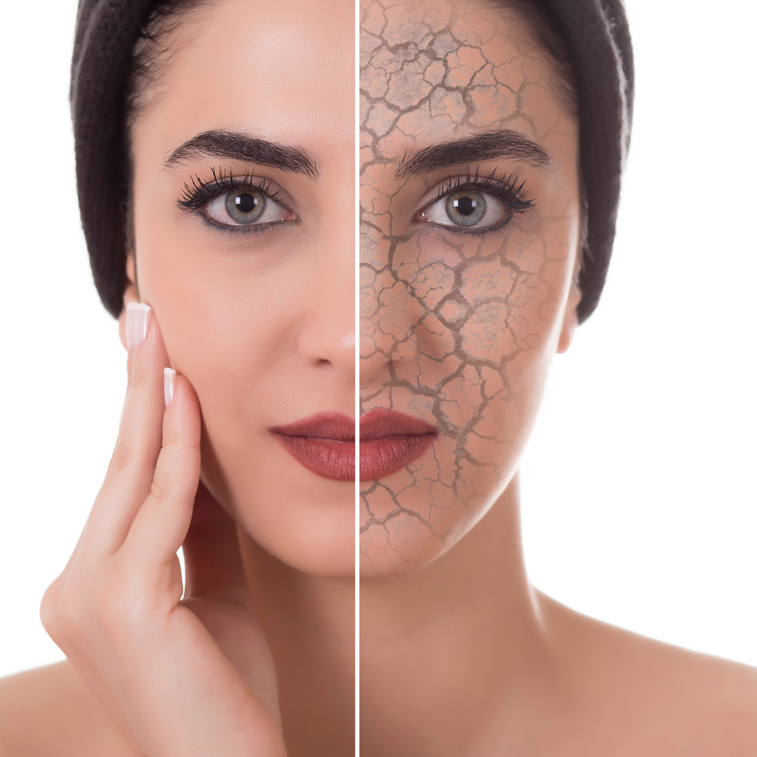 Comprendre votre peau : sèche ou déshydratée – La maison Maeva